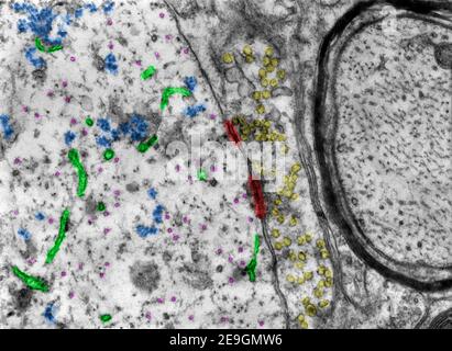 Ribosomes. Transmission electron micrograph of ribosomes and polysomes ...
