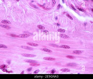 Smooth muscle fibers of the small intestine, longitudinally sectioned ...