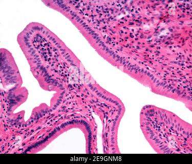 Simple columnar epithelium, light micrograph Stock Photo - Alamy