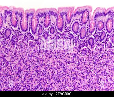 Light micrograph showing the mucous epithelium of gastric pits stained ...