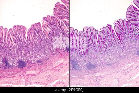 Stomach pylorus glands. Light micrograph of a section through glands ...
