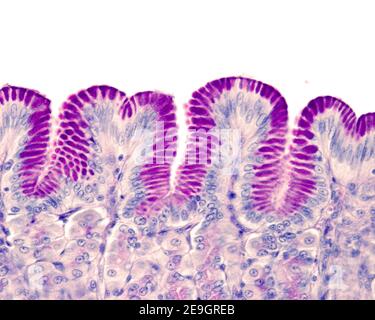 Gastric mucosa stained showing: surface epithelium, gastric pits with ...