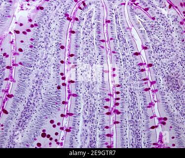 Intestinal villi stained with the Periodic Acid Schiff (PAS) staining ...