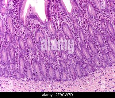 Small intestine tissue, light micrograph. Section through folds (villi ...