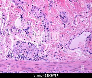 Meissner plexus in the submucosa of the digestive tract showing two ...