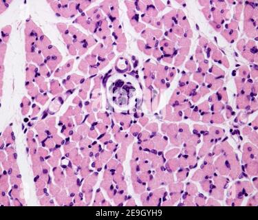 Peripheral nerve. Light micrograph of a cross section through an osmium ...