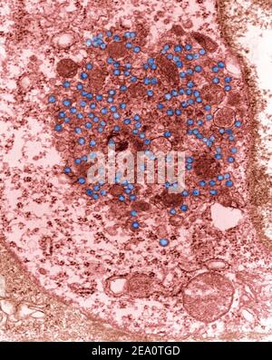 Retrovirus infection. Coloured transmission electron micrograph (TEM ...