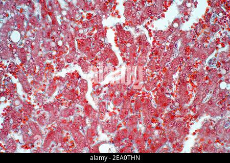 Liver cells, light micrograph Stock Photo - Alamy
