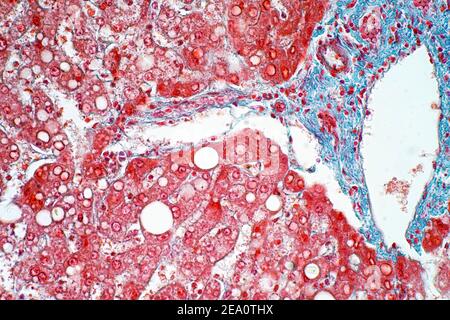 Liver cells, light micrograph Stock Photo - Alamy