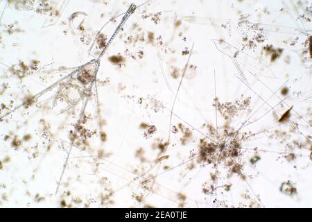 Marine plankton, light micrograph Stock Photo - Alamy