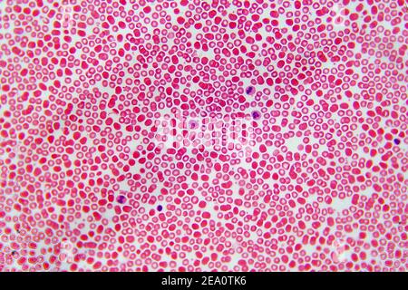 Blood smear, light micrograph Stock Photo - Alamy