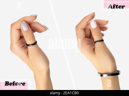 Womans hands before and after manicure correction procedure Stock Photo ...