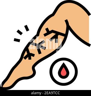 Venous disease edema color line line icon. Vector varicose vein and ...