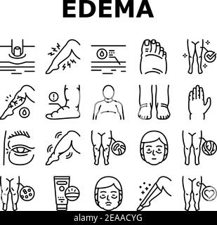 Edema Disease Symptom Collection Icons Set Vector Stock Vector Image ...