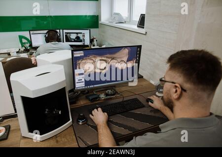 3D Printing Dental Crowns and Bridge Models. Orthodontic model for ...