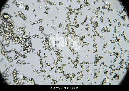 Orange mold spores under the light microscope, uncolored mold sample ...