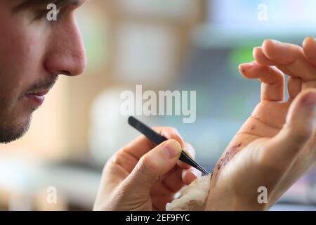 Abrasions on the palm and scratches on the right arm of an adult man ...