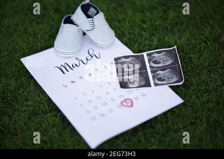 Closeup shot of the ultrasound of the baby, baby shoes and a calendar ...
