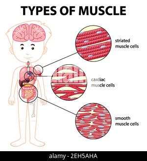 Types of muscle cell diagram illustration Stock Vector Image & Art - Alamy