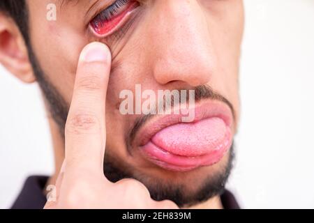 Guy pulling his eye lid down and sticking his tongue out as symbol of ...