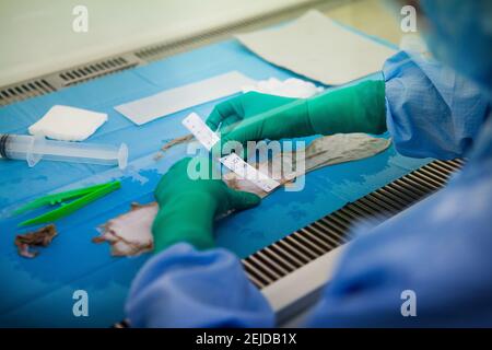 Preparation of skin samples for skin grafting Stock Photo - Alamy