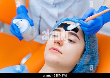 Dermatologist smears black mask on face for laser photorejuvenation and ...