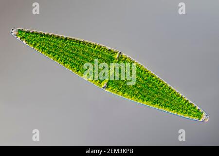 Closterium (Closterium spec.), light microscope image, colour-DIC ...