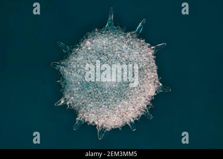 radiolarians (Radiolaria), fossil radiolarians from Barbados, dark ...