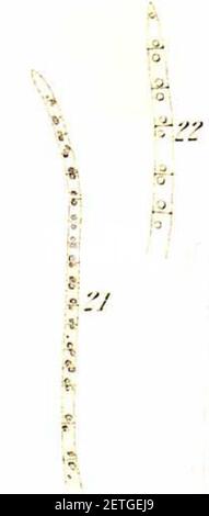 Phormidium laminosum by Gomont 1892 Stock Photo - Alamy