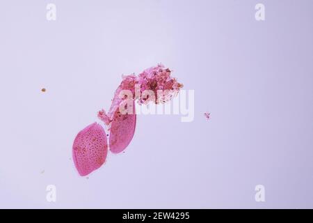 small intestine under the microscope Stock Photo - Alamy