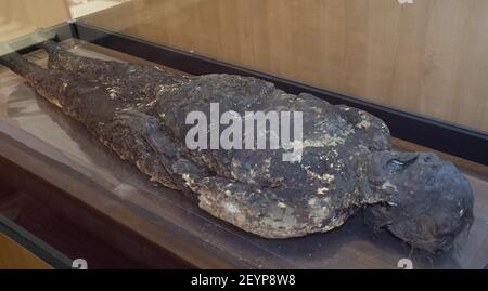 The "Soap Woman" mummy is on display at the Mutter Museum of The ...