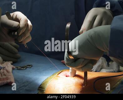 Dr. Adrian G. Dan, an advanced laparoscopic surgeon, readies the ...