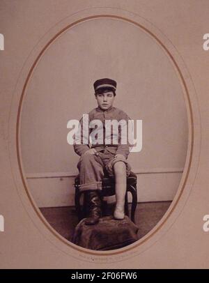 Pirogoff Amputation 2 Stock Photo - Alamy