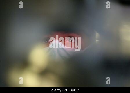 Dr. Hrayr Shahinian performs minimally invasive brain surgeries by ...