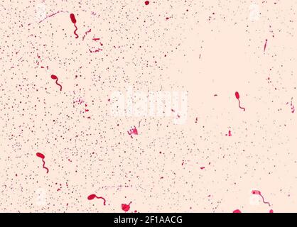 Cholera bacteria (Vibrio cholerae) in human small intestine, computer ...