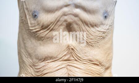 The thin old man skin with close-up old skin with the surgical wound ...