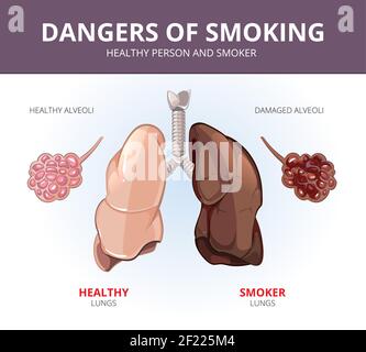 An Education Poster of Smoking and Health illustration Stock Vector ...