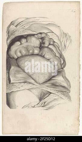 Anatomical study of the intestines and the belly of a pregnant woman ...