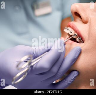 Close-up dentist hands placing a cartridge with dental anesthesia in ...