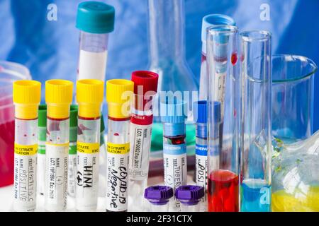 A closeup of colorful liquid chemical elements and a SARS blood test on ...