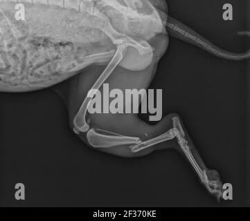 Tibial fracture, X-ray Stock Photo - Alamy