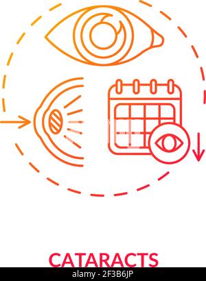 Cataracts abstract concept vector illustration Stock Vector Image & Art ...