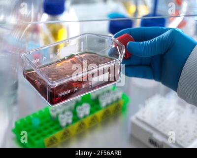 Scientist holding jar containing blood cells while doing experiment in ...