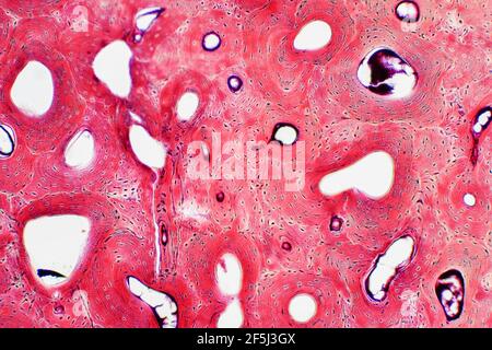 Human compact bone, light micrograph Stock Photo - Alamy
