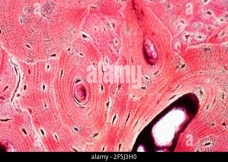 Human compact bone, light micrograph Stock Photo - Alamy