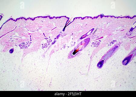 Light micrograph of human scalp skin showing hair follicles ...
