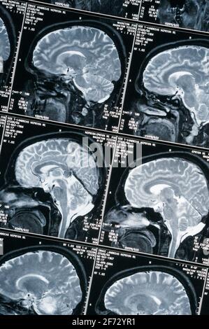 Cross-section of an human brain. Digital illustration Stock Photo - Alamy