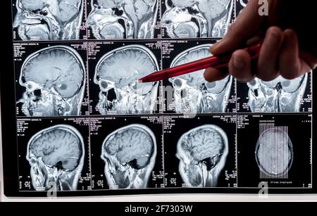 Cross-section of an human brain. Digital illustration Stock Photo - Alamy