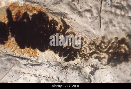 Human pinworm nematode Enterobius vermicularis, various stages in the ...