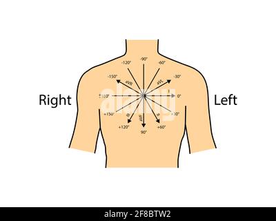 Einthoven ECG triangle, including augmented unipolar limb lead ...